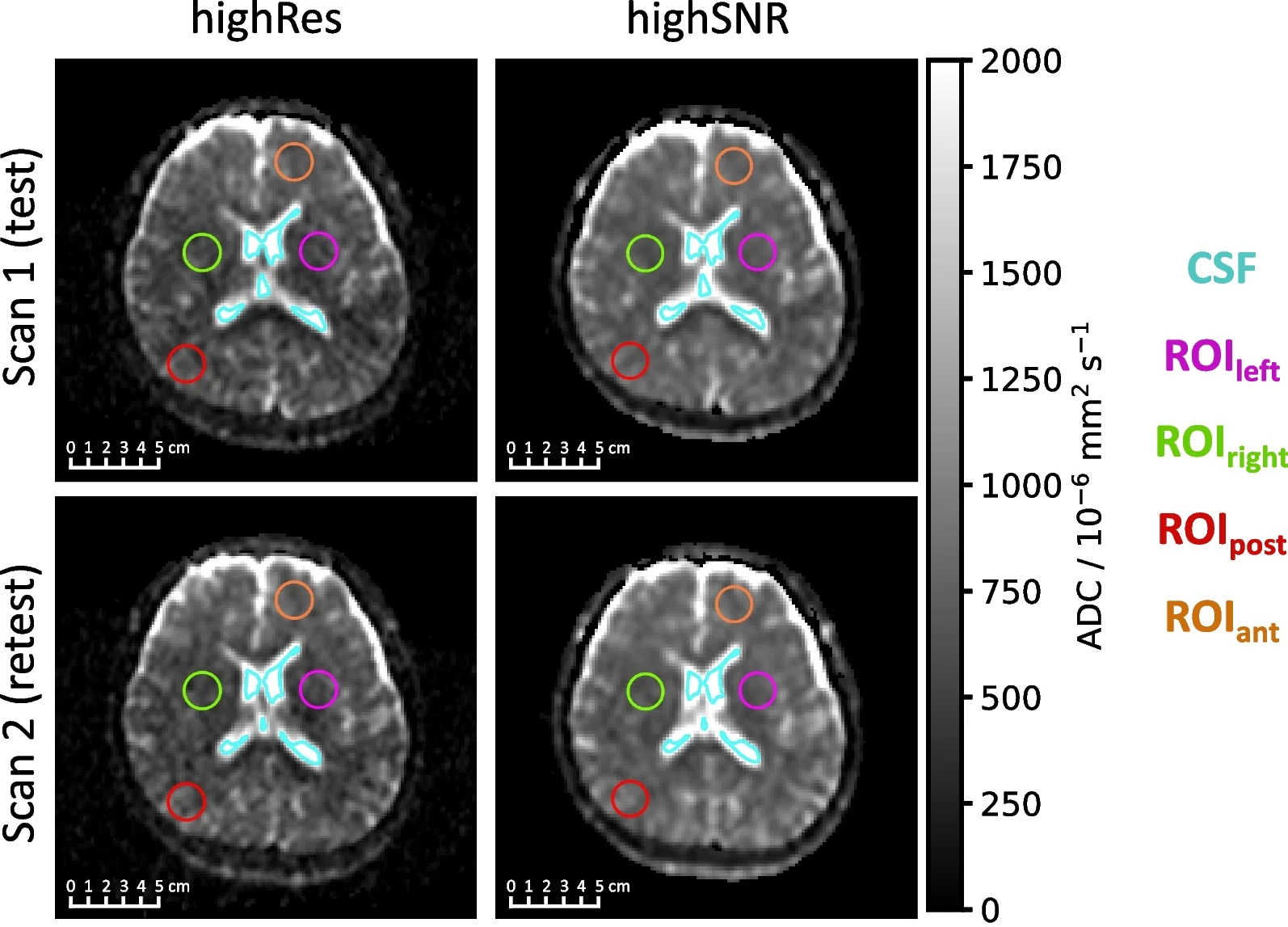 First DWI results | LMU ART Lab