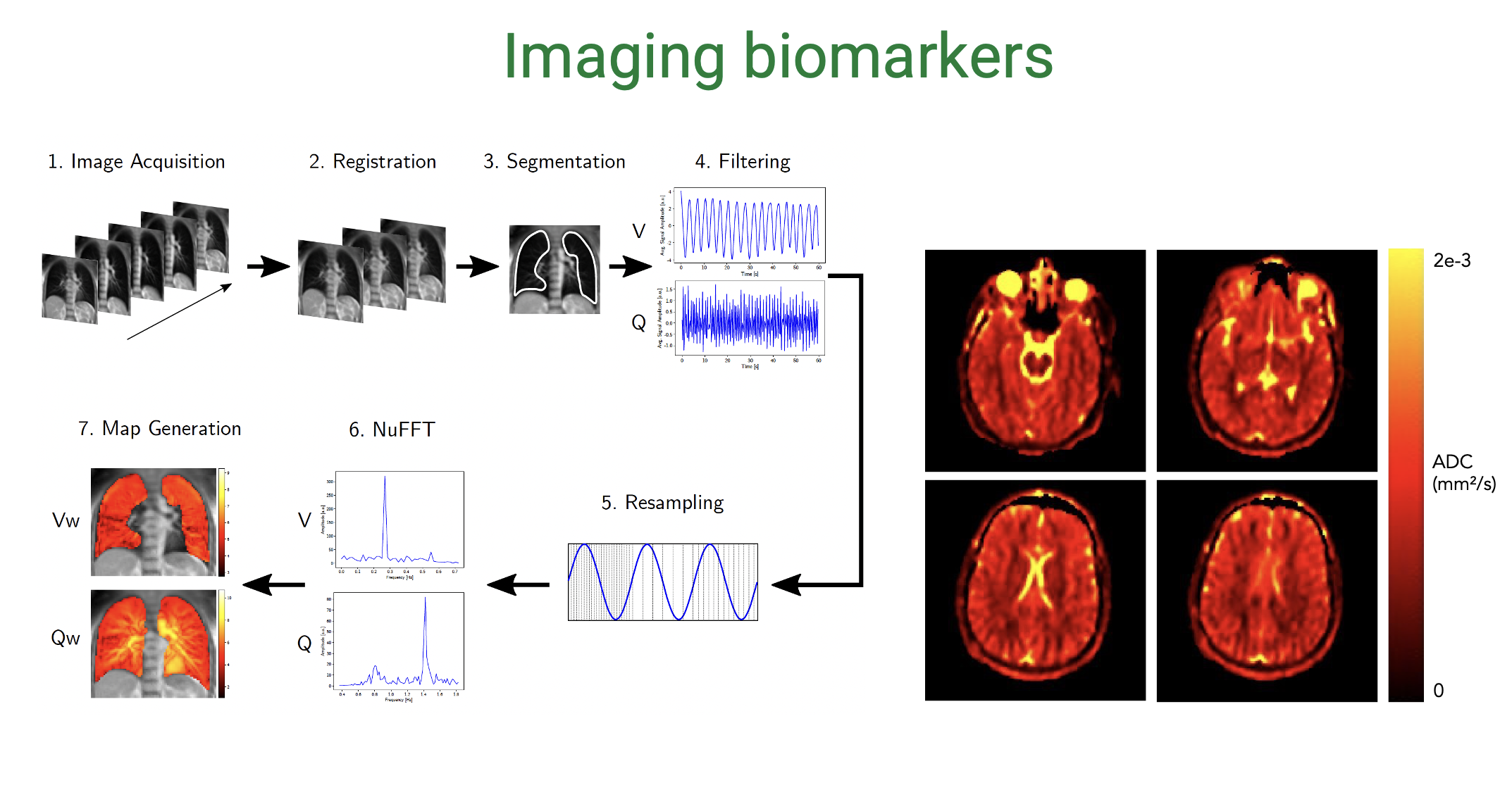 Imaging biomarkers | LMU ART Lab
