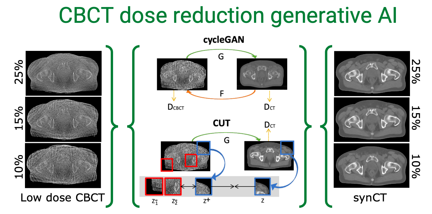 CBCT Dose Reduction with Generative AI | LMU ART Lab