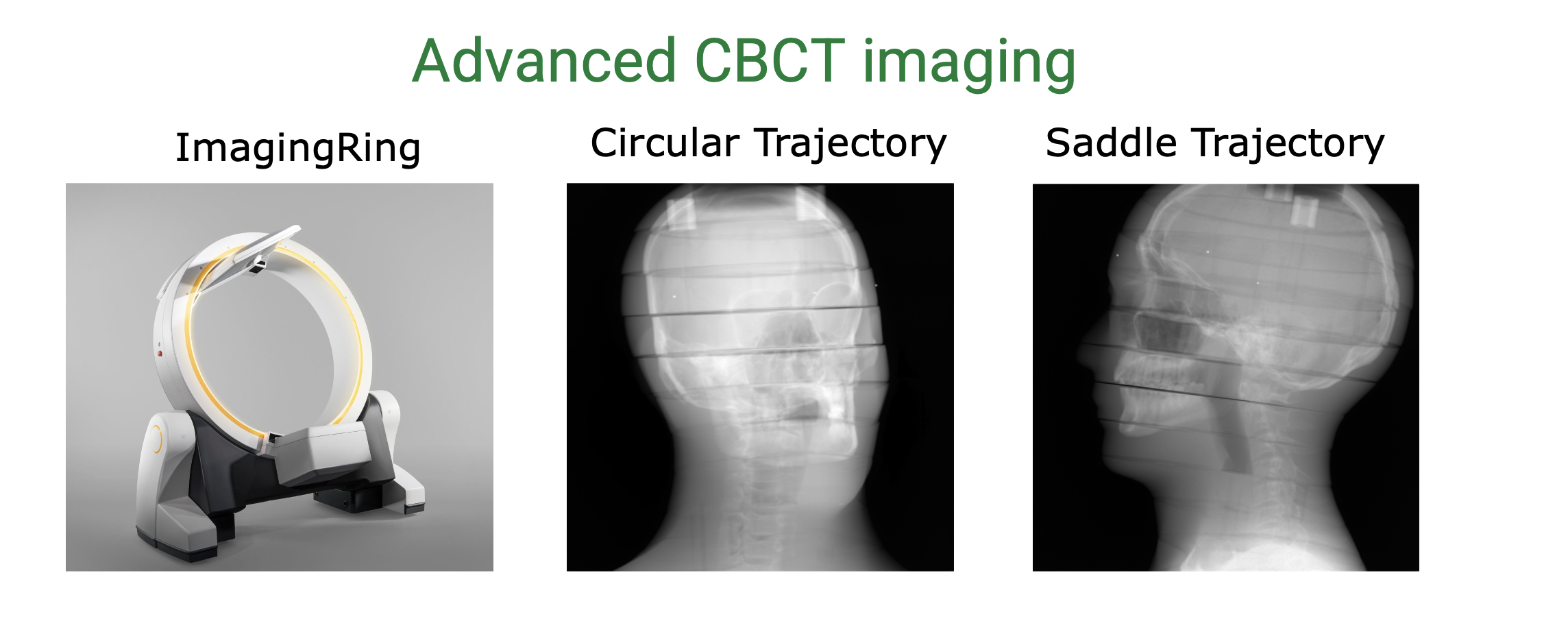 Advanced CBCT Imaging | LMU ART Lab