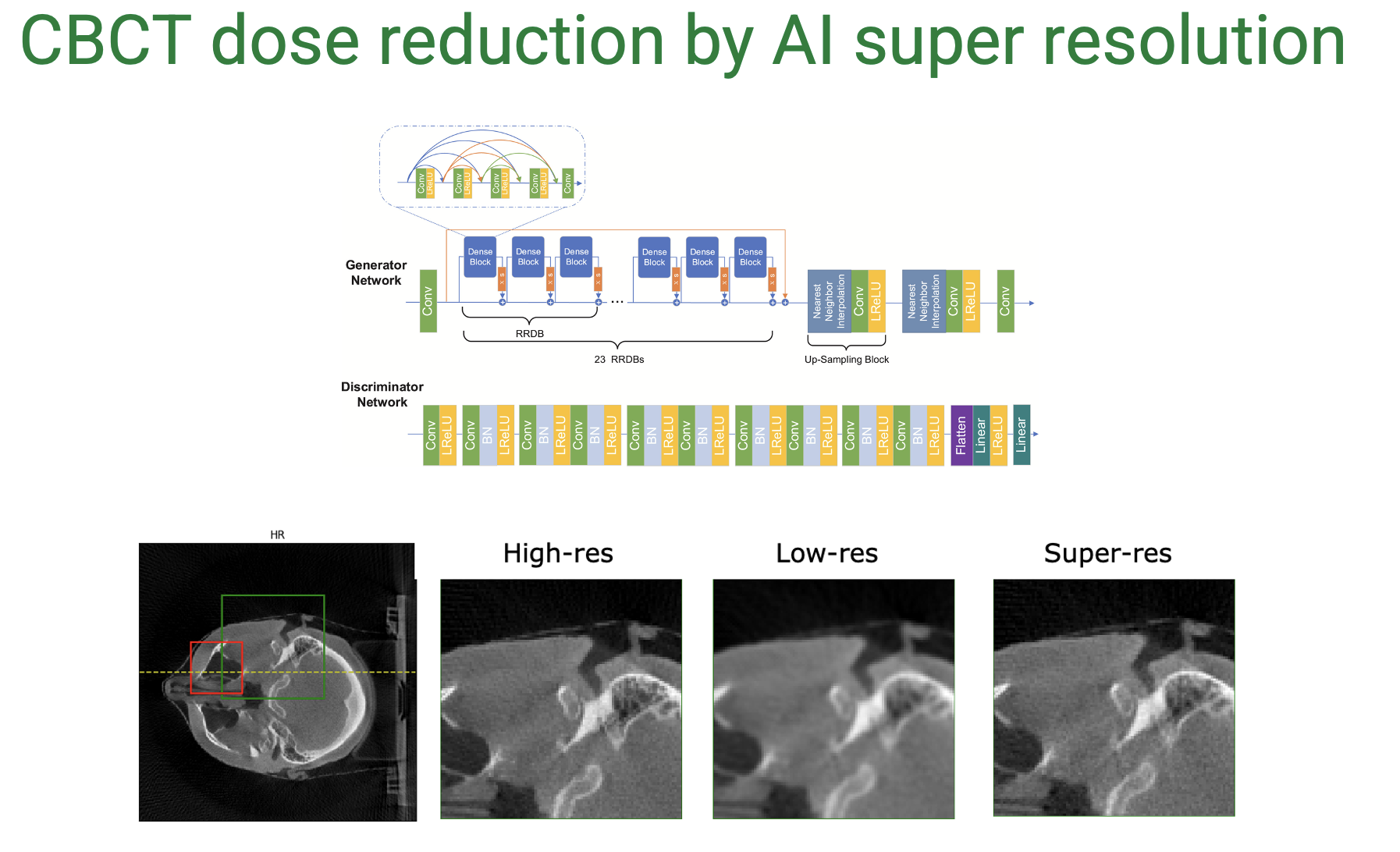 CBCT Dose Reduction with AI Super-Resolution | LMU ART Lab
