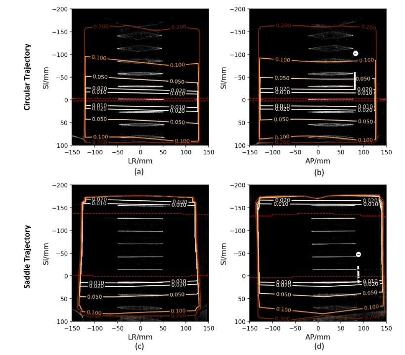 DFG Image-guided brachytherapy with real-time navigated needle ...