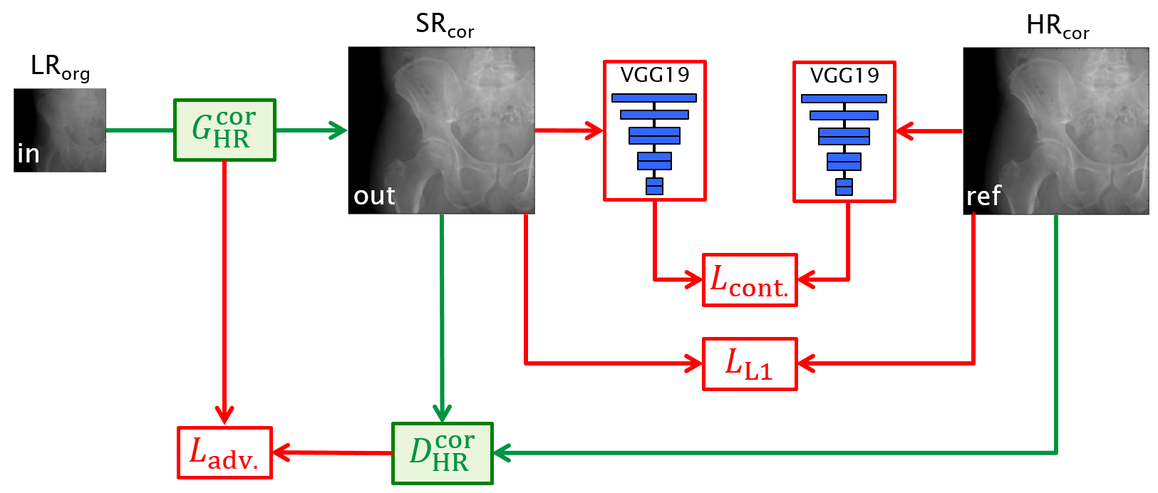 Deep learning for dose reduction and auto-segmentation in CBCT-guided online adaptive ...